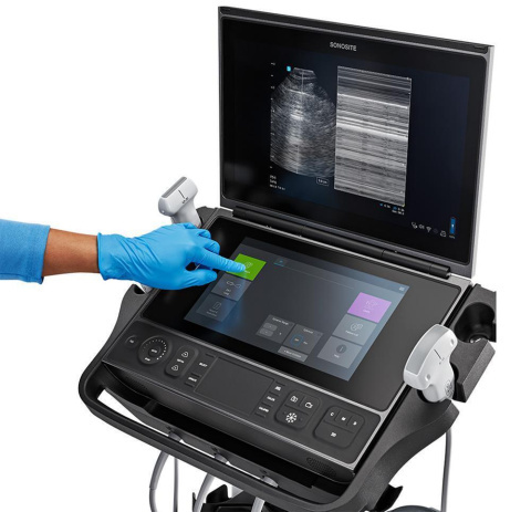 Sonosite PX Portable Ultrasound Machine | FUJIFILM Sonosite